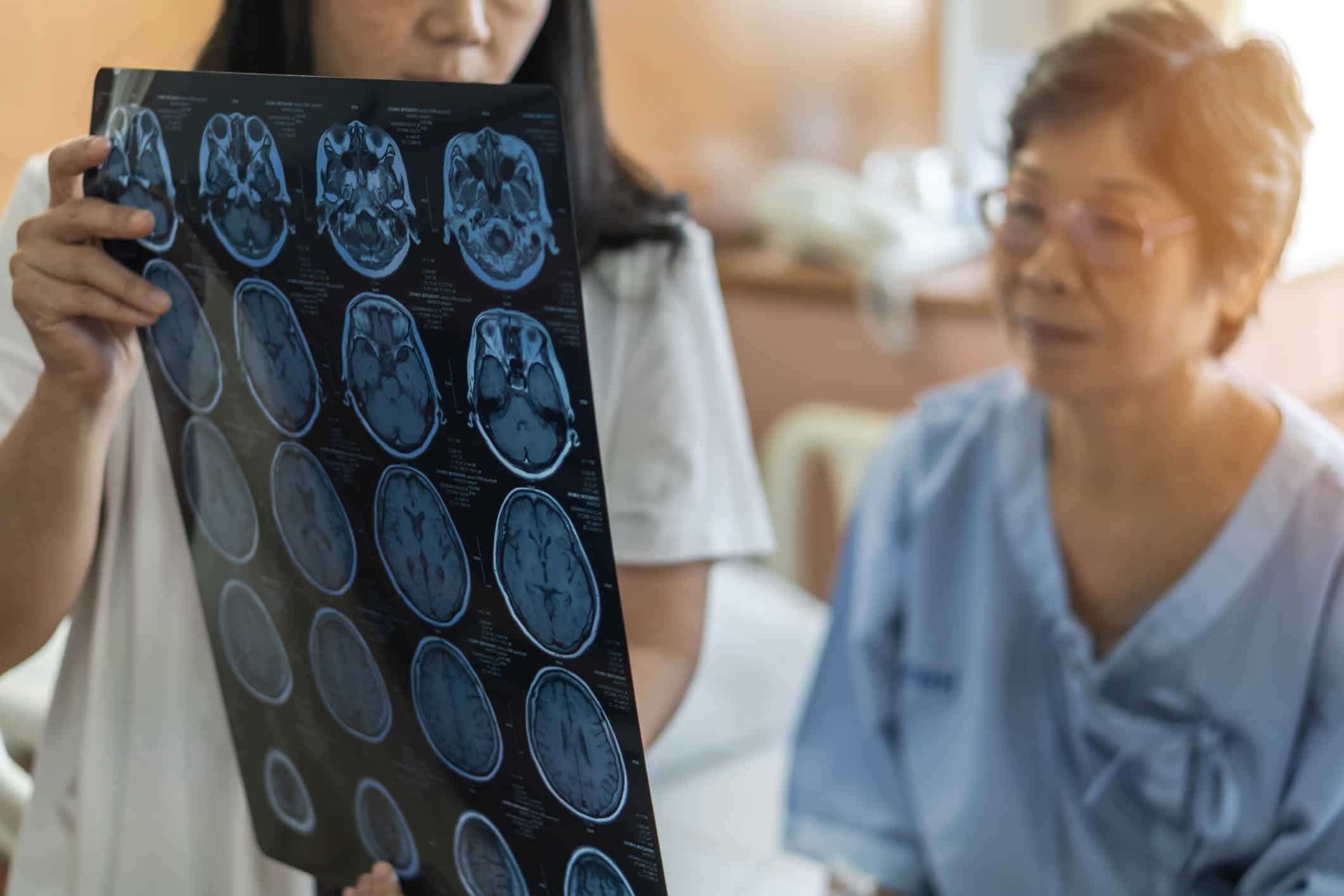 Behavioral Neurology & Neuropsychiatry Specialists in Houston - UT ...