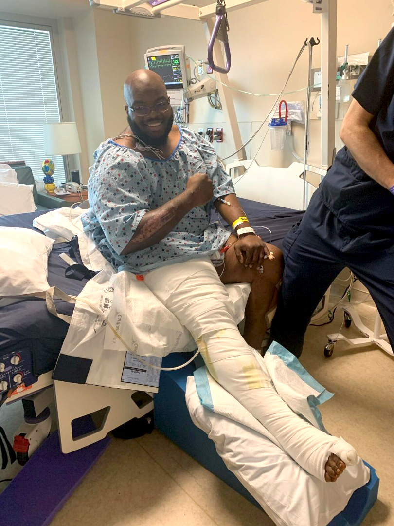 Surgeon Repairs Femur After Motorcycle Accident | UT Physicians