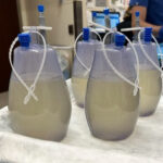 Genetic Testing Provides Critical Diagnosis | UT Physicians